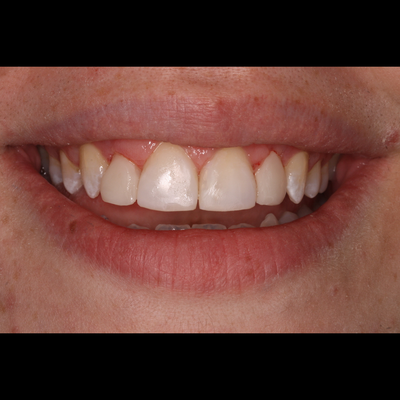 Digital Smile Design | DSD Dental | Smile Design Center // 3Dental In ...