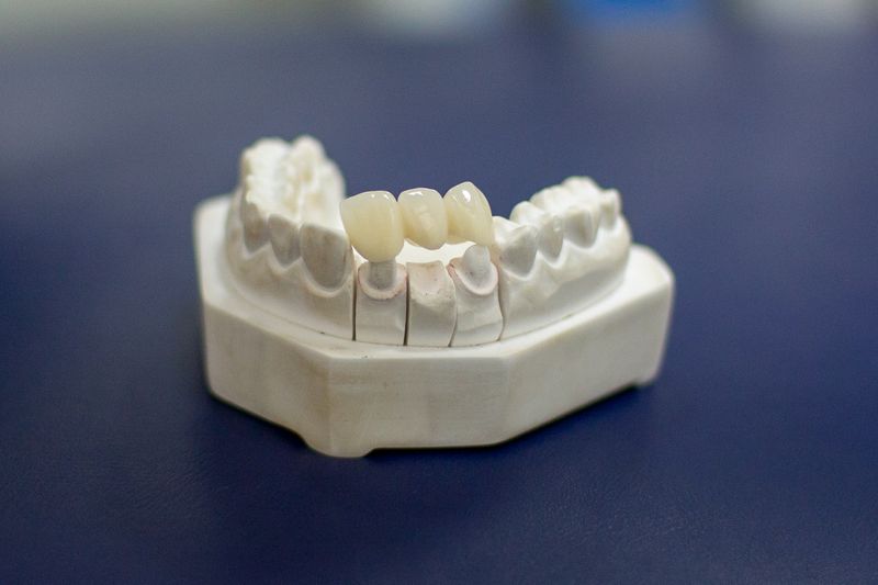 Prosthodontic Treatments | Dental Prostheses // 3Dental In Dublin ...